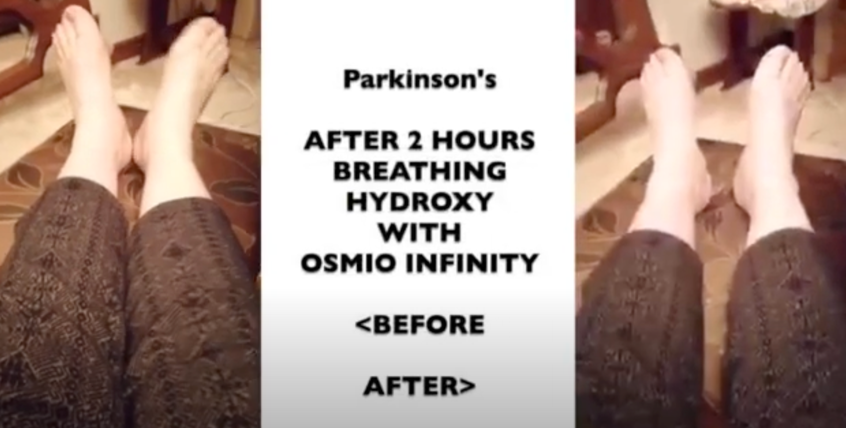 Hydroxy Therapy – hydrowerks